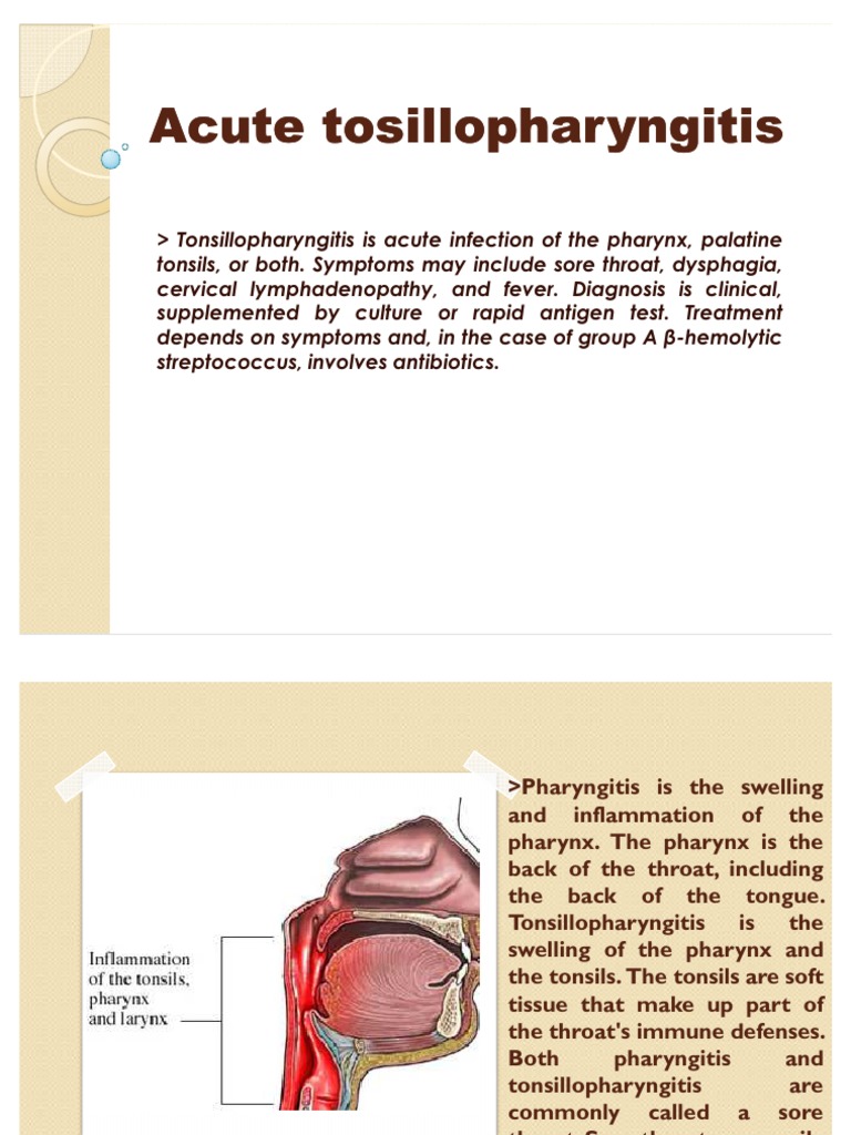 Acute Tosillopharyngitis