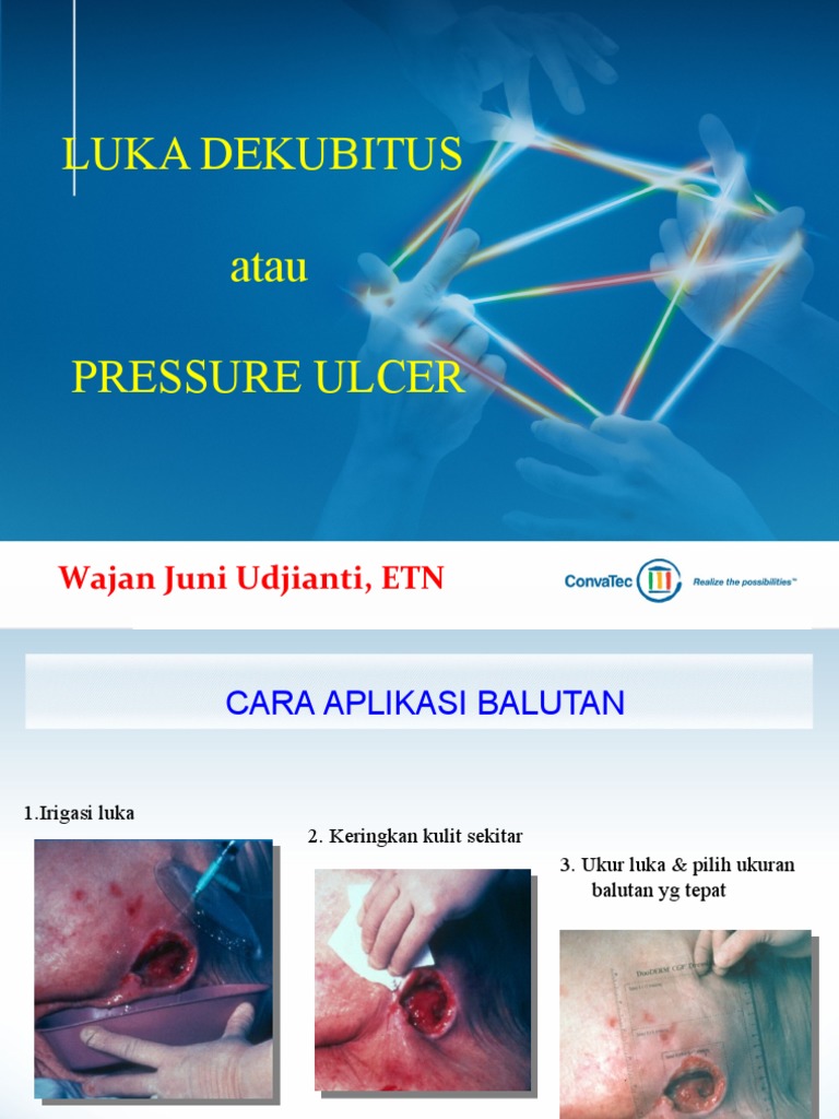 ConvaTec LUKA DEKUBITUS | PDF | Medicine | Surgery