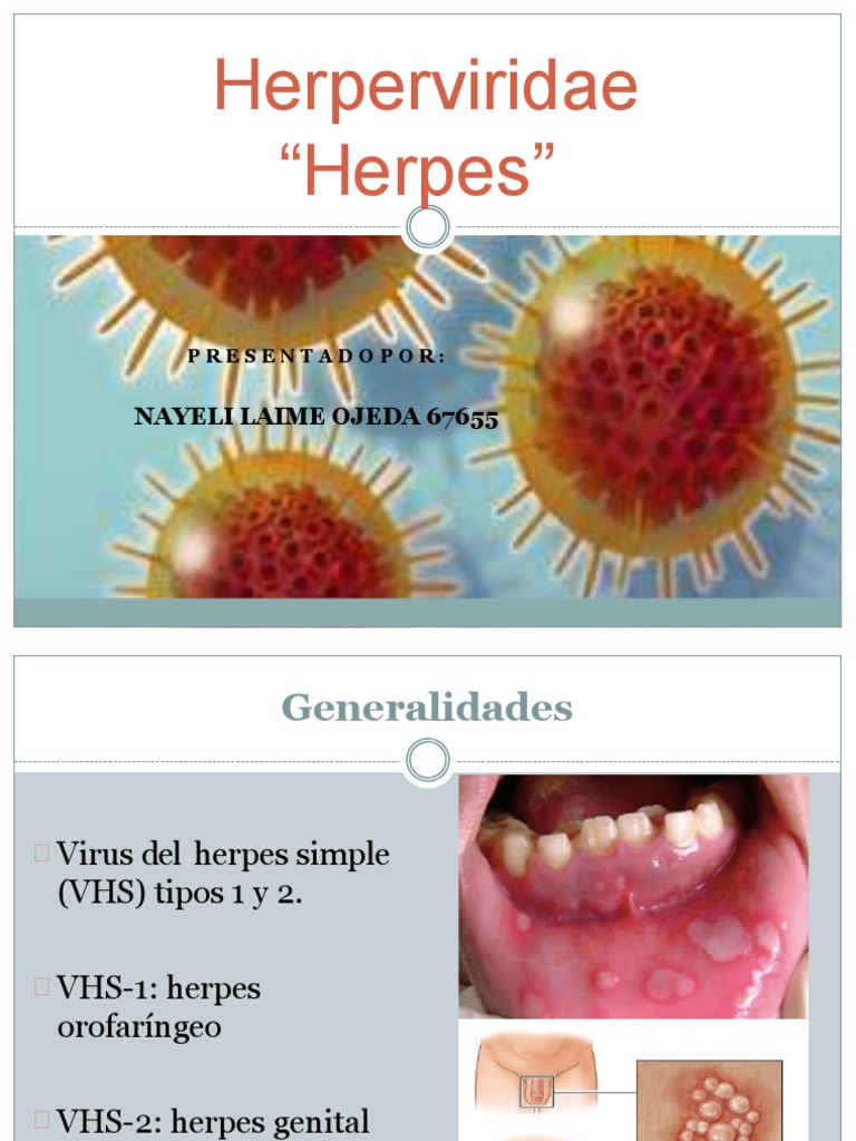 Herpes Simple: Tipos, Síntomas y Tratamiento | PDF