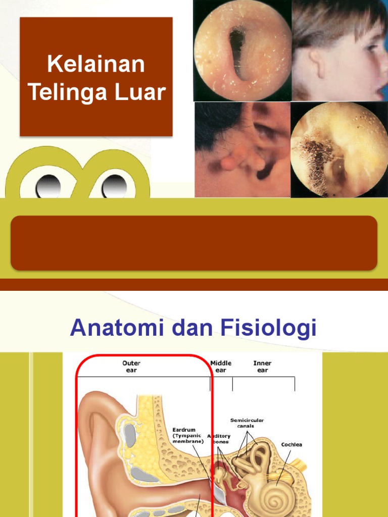 Kelainan Telinga Luar | PDF
