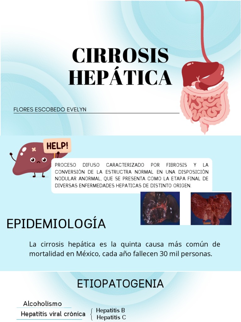 Cirrosis Hepatica EXPO | PDF | Cirrosis | Hepatitis