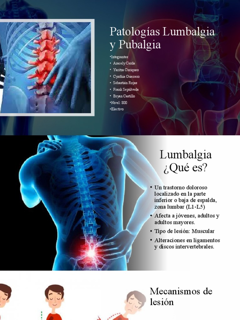 Patologías Lumbalgia y Pubalgia | PDF | Dolor lumbar | Especialidades ...