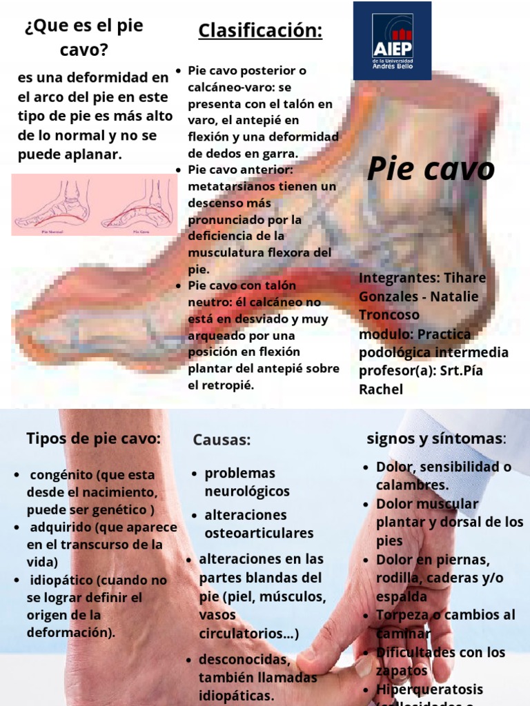 Pie Cavo | PDF | Pie | Sistema musculoesquelético