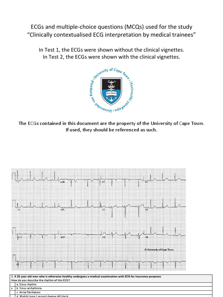 Supplementary Material - ECG Test | PDF | Electrocardiography ...