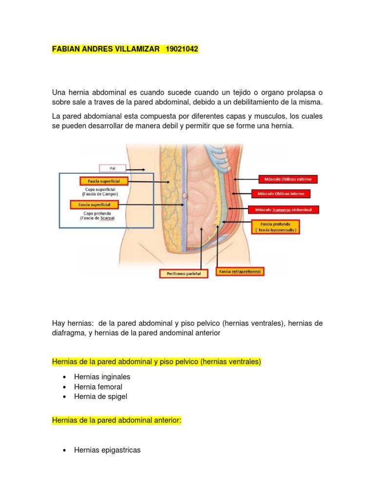 Tipos de Hernias | PDF | Abdomen | Anatomía