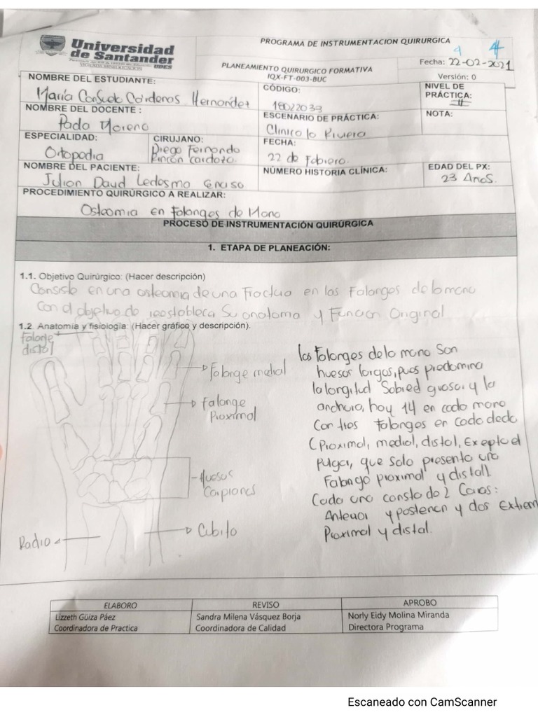 Osteomia en Falanges de Mano | PDF