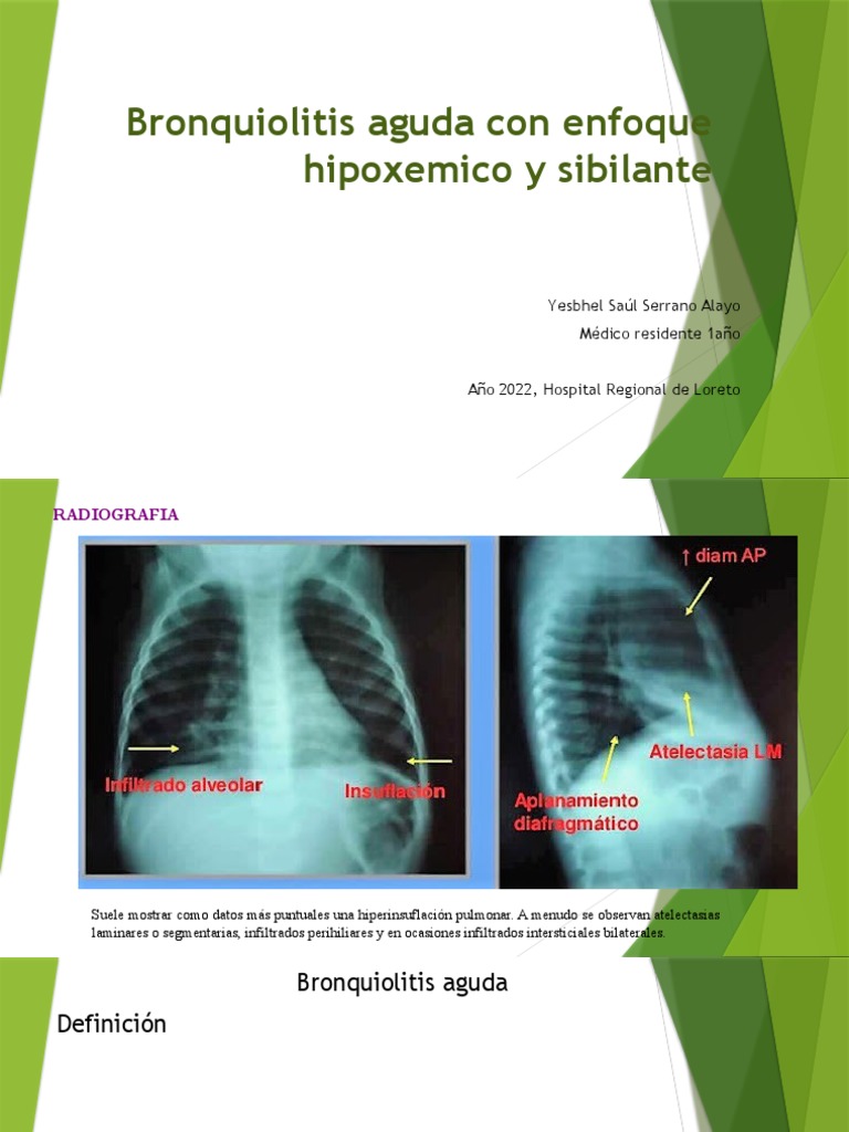 Bronquiolitis A | PDF | Medicina CLINICA | Neumología