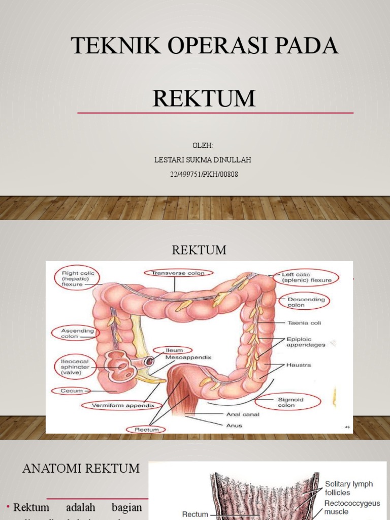 Teknik Operasi Pada Rektum Fix | PDF | Sains & Matematika