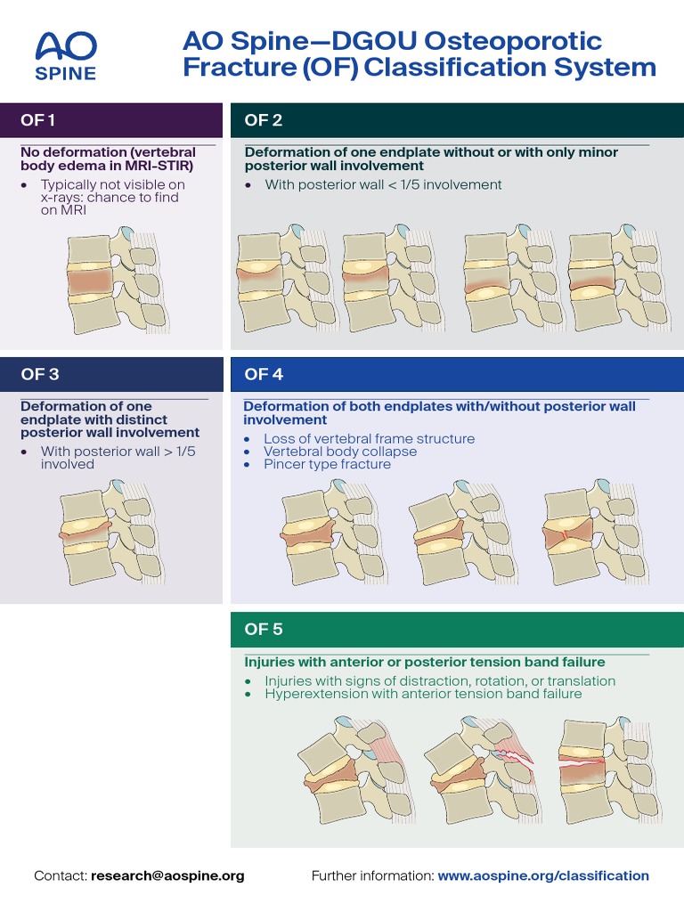 AO Spine Osteoporotic Classification Pocket Card | PDF | Osteoporosis ...
