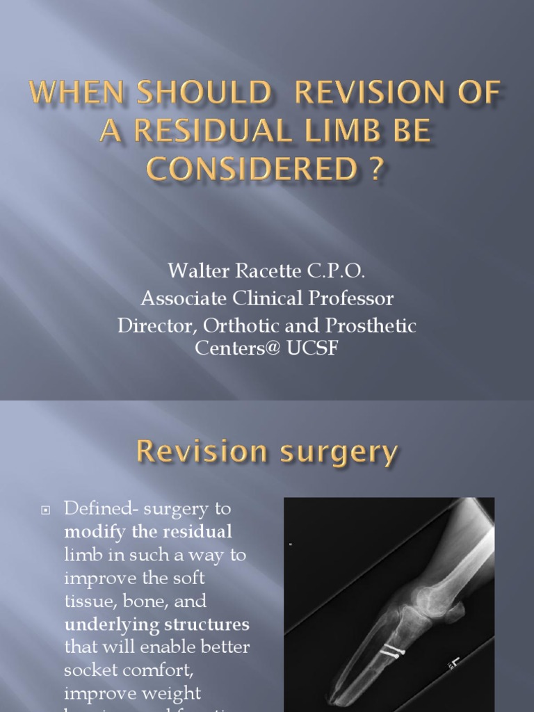 When Should Revision of A Residual Limb Be Considered | PDF ...