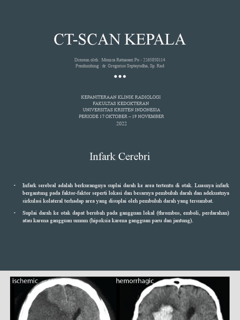Ct-Scan Kepala - Monica Ratnasari Po - 22656050114 | PDF | Sains ...