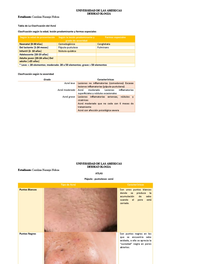 Tabla de La Clasificación Del Acné | PDF | Medicina CLINICA | Enfermedades y trastornos