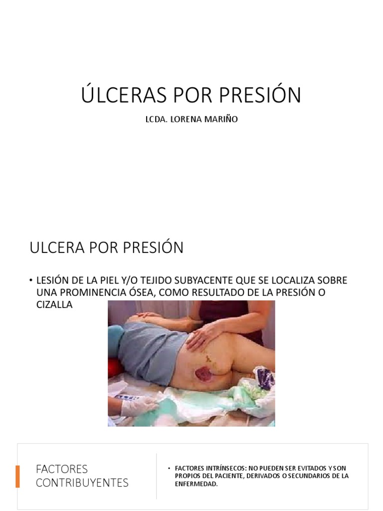 Úlceras Por Presión 1 | PDF