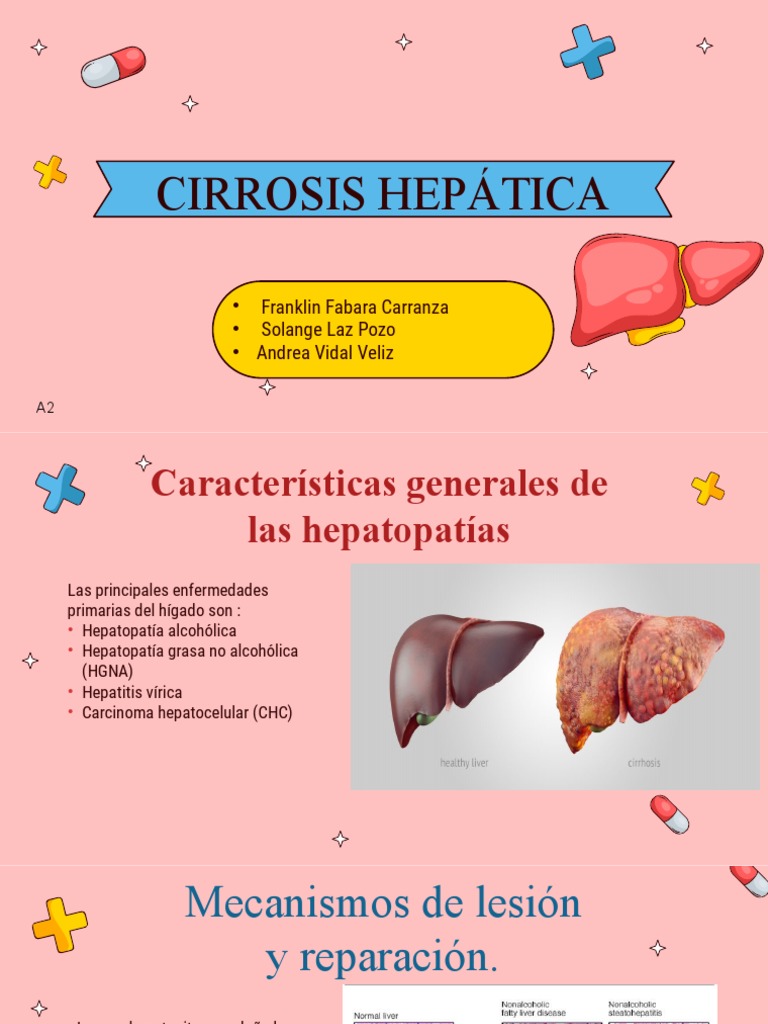 Cirrosis Hepatica | PDF