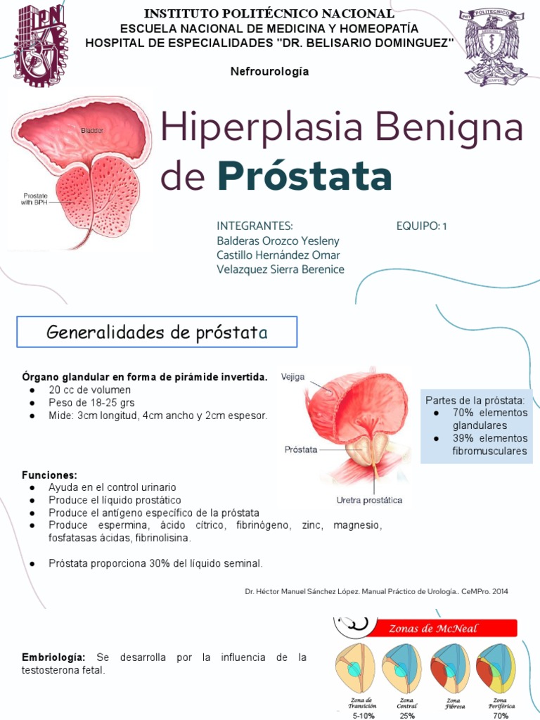 Hiperplasia Benigna De: Próstata | PDF | Cancer de prostata | Vejiga ...