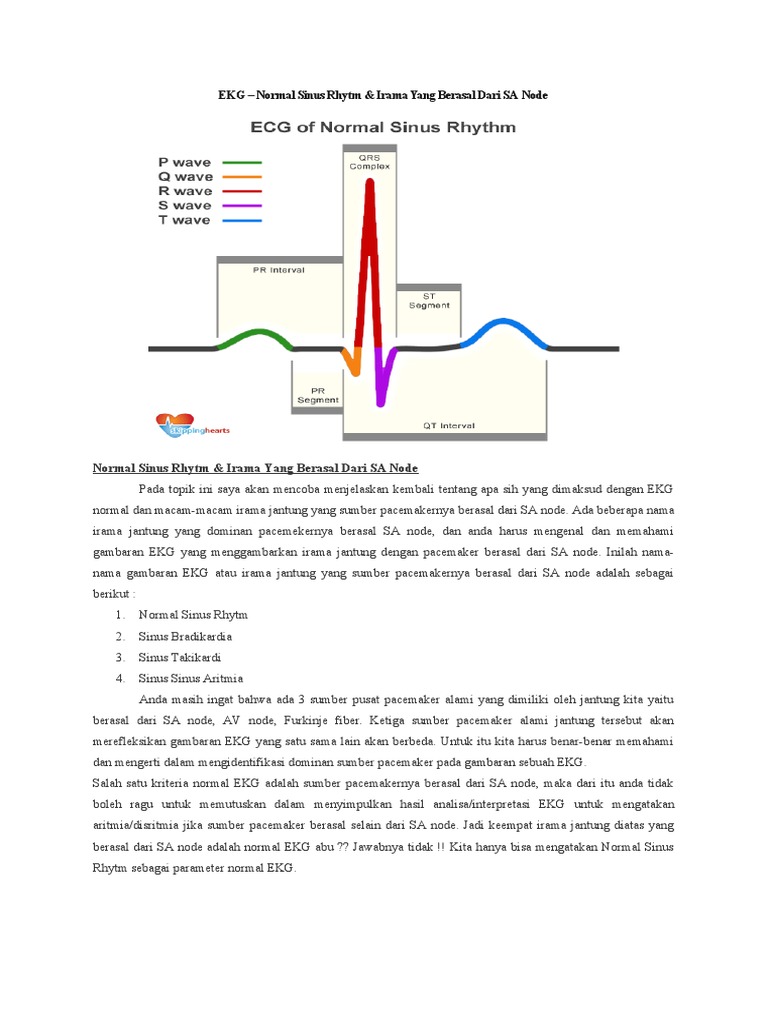 Irama Jantung Ekg | PDF