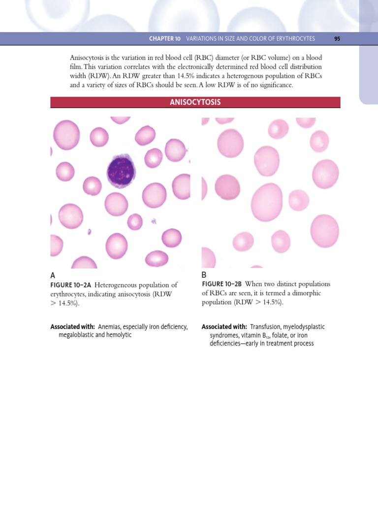Clinical Hematology Atlas (PK 1) (03-04) | PDF | Anemia | Red Blood Cell