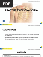 Clasificación y Tratamiento de Fracturas de Escápula | PDF | Hombro ...