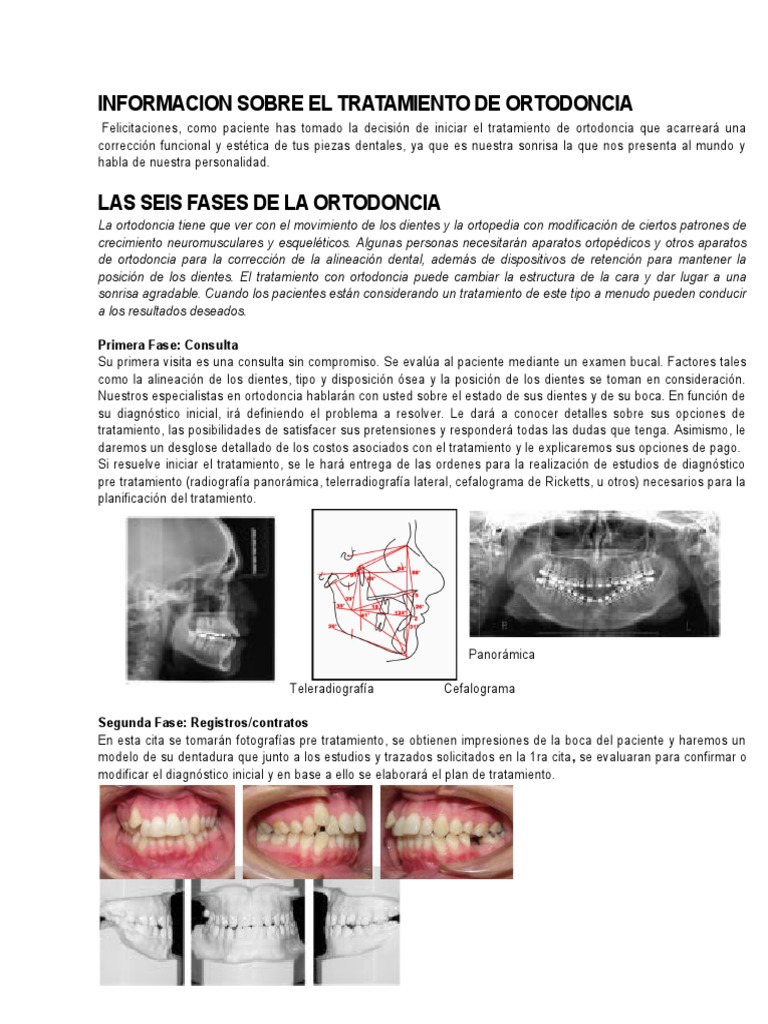 Las Seis Fases DEL TRATAMIENTO DE ORTODONCIA | PDF | Ortodoncia | Ramas ...