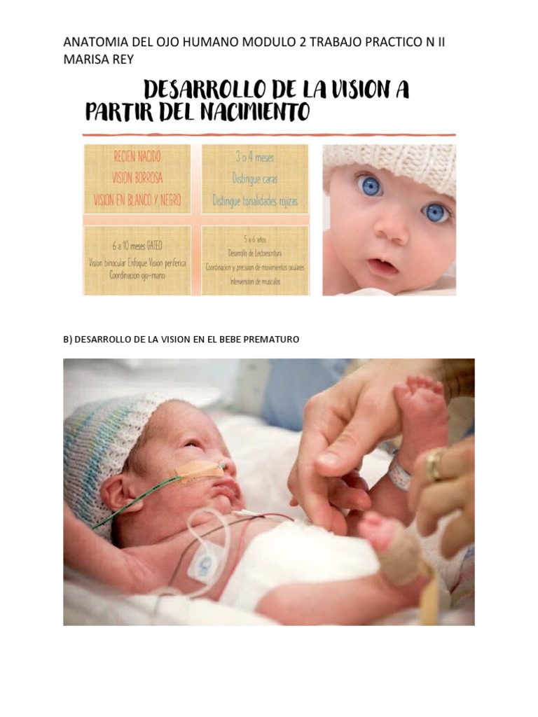 Anatomia TPII Modulo 2 Vision Bebe | PDF | Percepción visual | Ojo humano