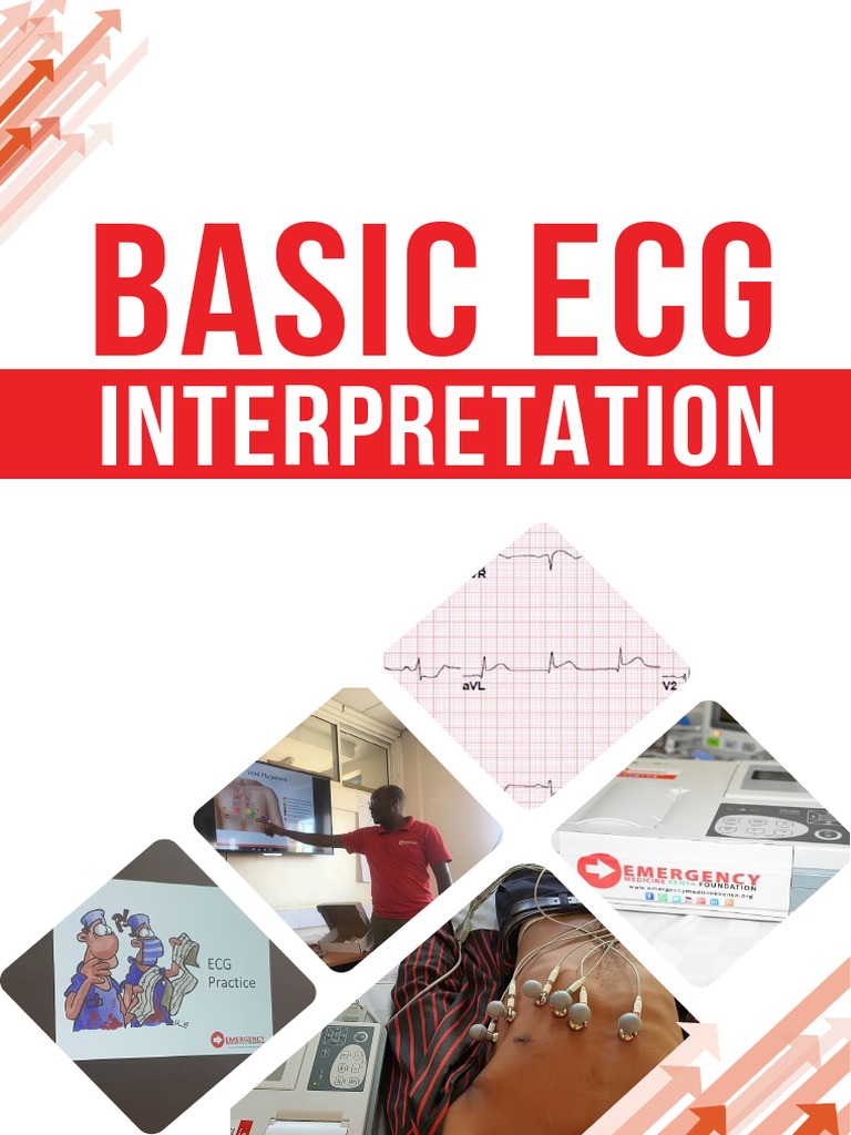 Basic ECG Interpretation | PDF | Electrocardiography | Heart