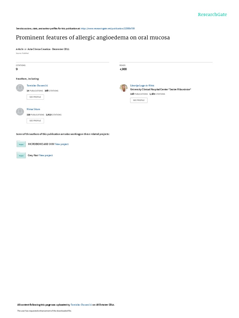 Jurnal Angioneurotic Edema | PDF | Allergy | Allergen