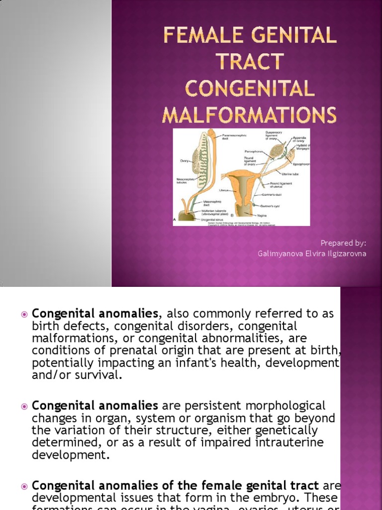 Female Genital Tract Congenital Malformations | PDF | Uterus | Vagina