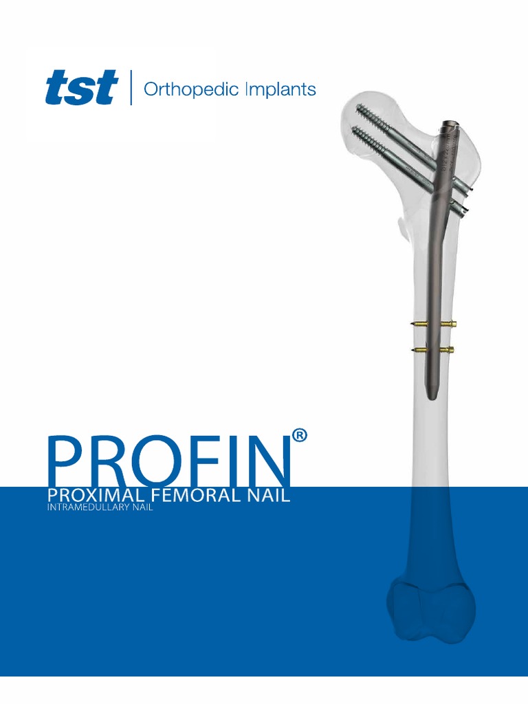 Proximal Femur Fracture Fixation with the PROFINA Intramedullary Nail | PDF