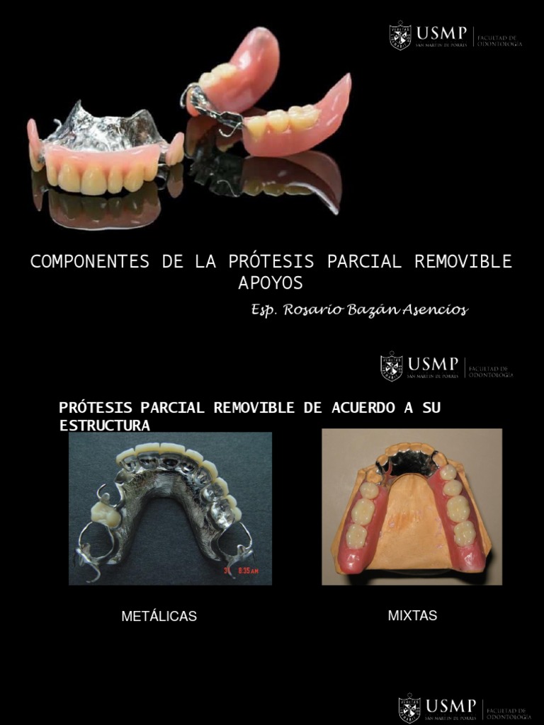 TEORIA 5. Componentes de La PPR-Apoyos | PDF | Dentadura postiza | Boca