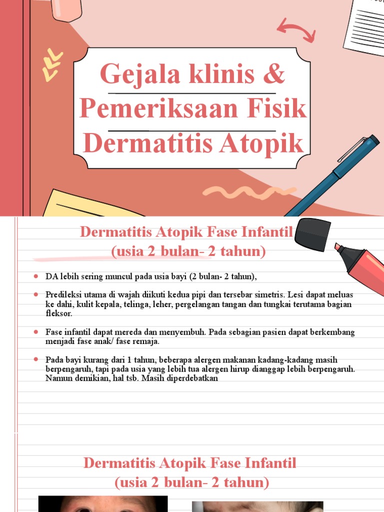 Dermatitis Atopik | PDF