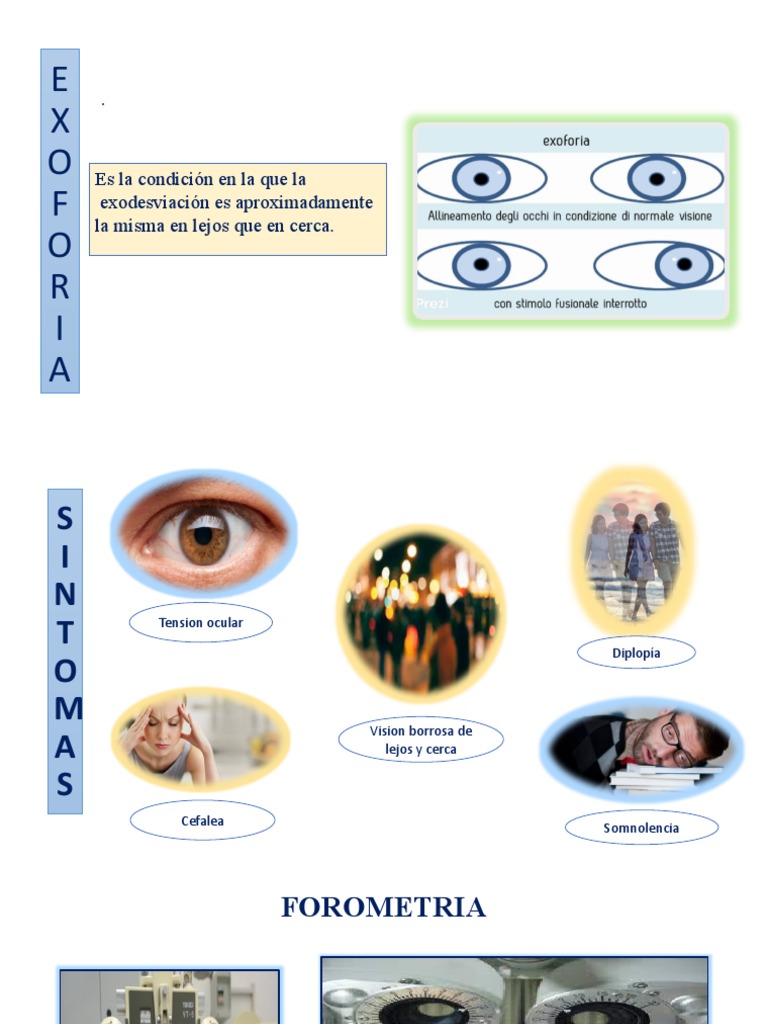Exoforia: Síntomas y Diagnóstico | PDF