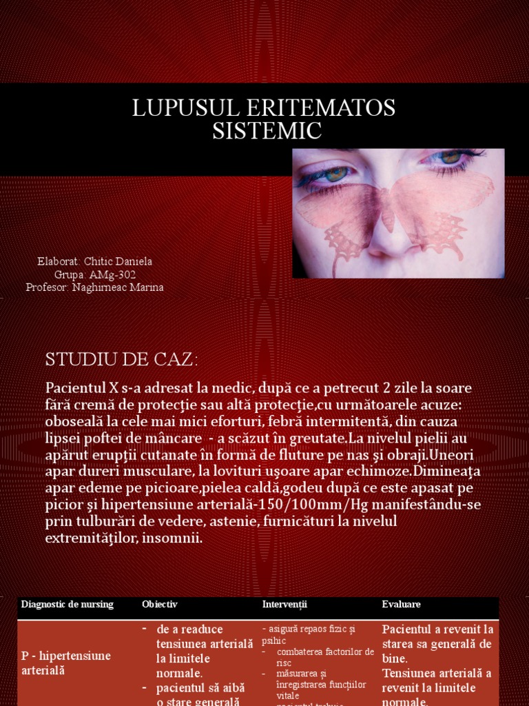 Lupusul Eritematos | PDF