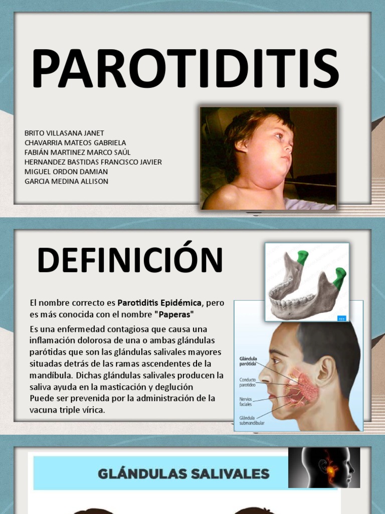 Parotiditis Equipo 11 | PDF | Inmunología | Enfermedades y trastornos