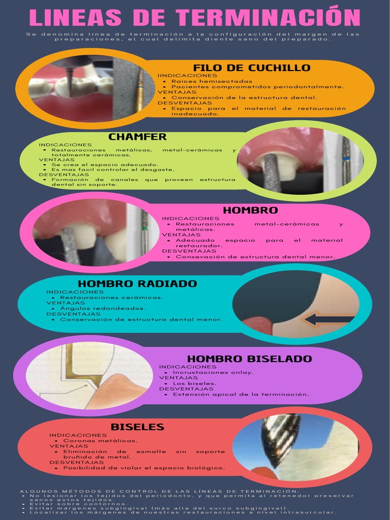 Infografía - Líneas de Terminación | PDF | Diente | Ramas de Odontología