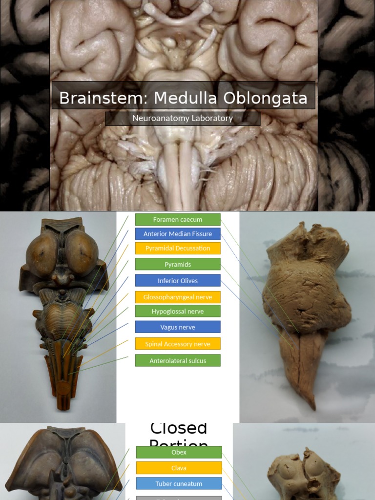 Brainstem | PDF | Brainstem | Brain