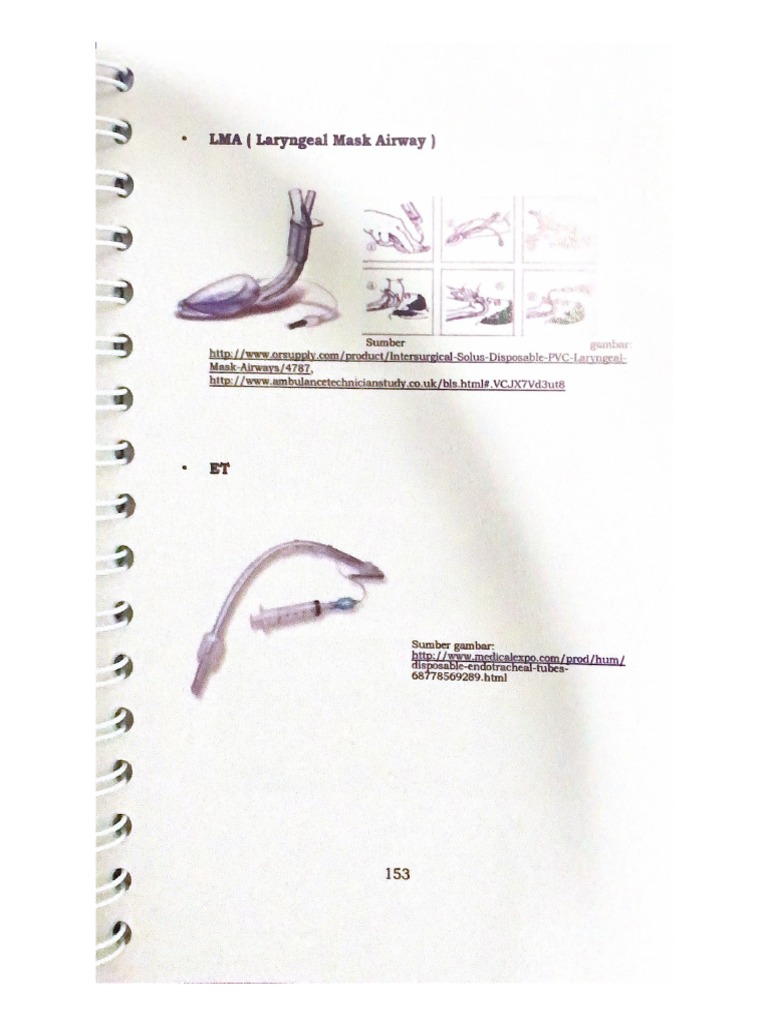 LMA (Laryngeal Mask Airway) | PDF