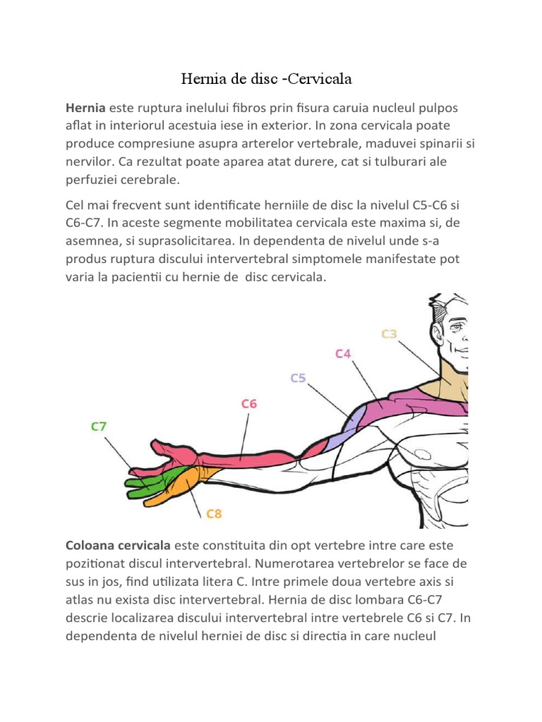 Hernia de Disc Cervicala | PDF