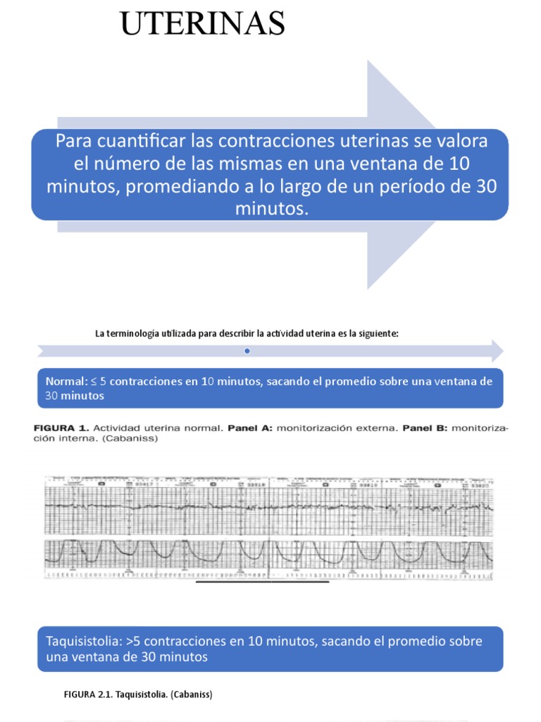 Análisis de Contracciones Uterinas y FCF | PDF | Parto | El embarazo