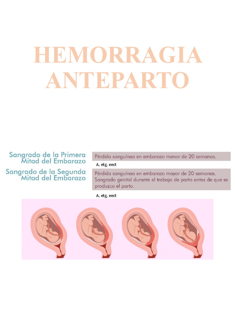 Hemorragia Anteparto | PDF | El embarazo | Aborto espontáneo