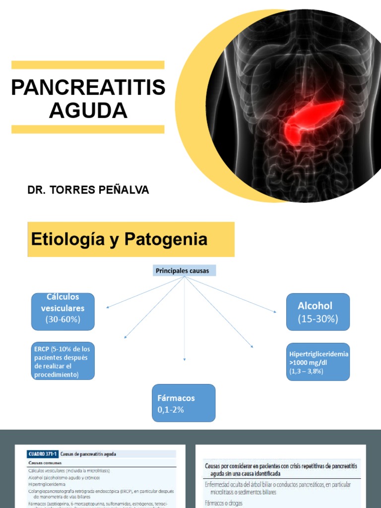 Guía Clínica de Pancreatitis Aguda | PDF | Causas de la muerte ...