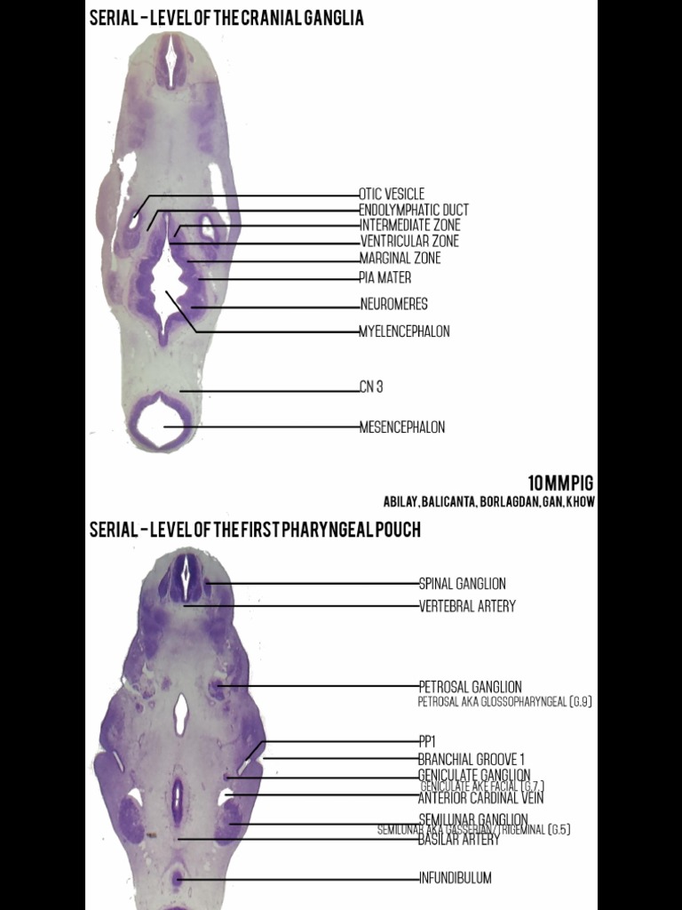 10 MM Pig Embryo | PDF