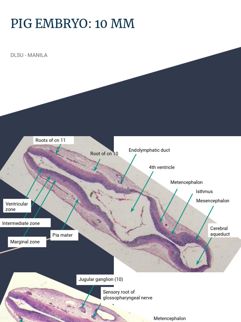Serial Sections of 10 MM Pig Embryo | PDF | Aorta | Liver