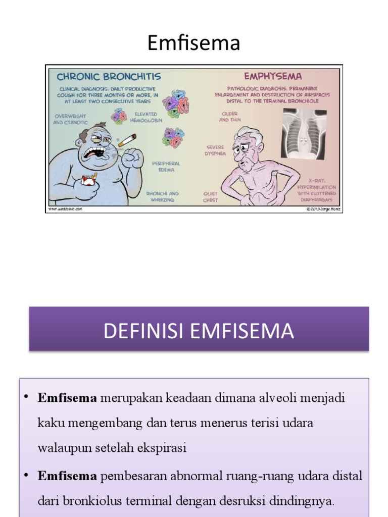 Emfisema | PDF