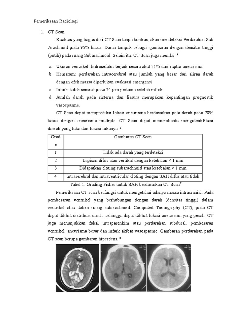 Gambaran CT Scan Perdarahan SAH | PDF | Sains & Matematika