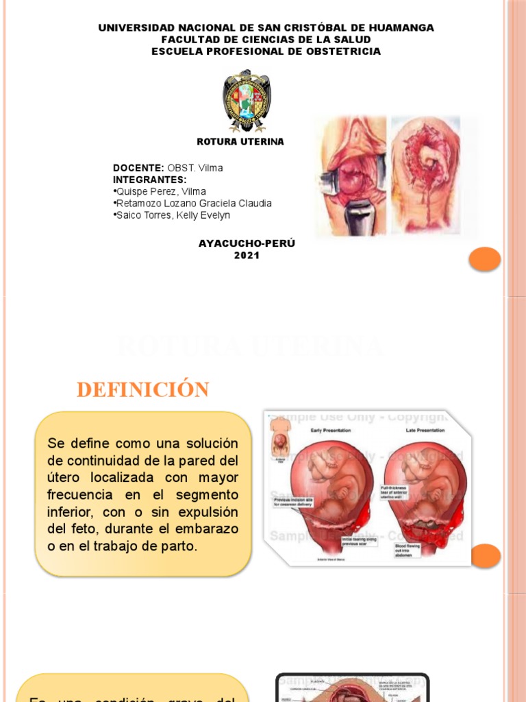 Ob Rotuna Uterina | PDF | Parto | El embarazo