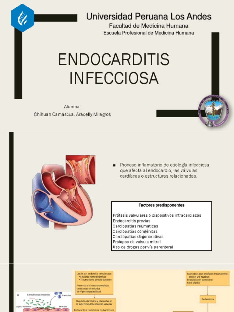 Endocarditis: Síntomas y Diagnóstico | PDF | Medicina CLINICA | Inmunología