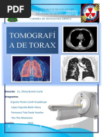 Pitch y TC Helicoidal | PDF | Ct Scan