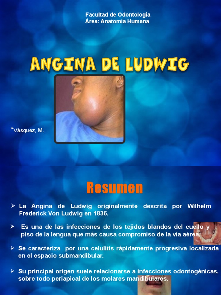 Diapositivas. ANgina de Ludwig | PDF | Odontología | Causas de la muerte