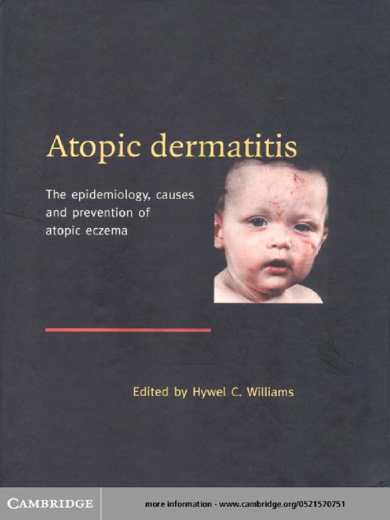 Atopic Dermatitis - The Epidemiology, Causes and Prevention of Atopic ...