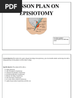 Crede'S and Ritgen'S Manuever Episiorrhapy Care: University of Northern ...